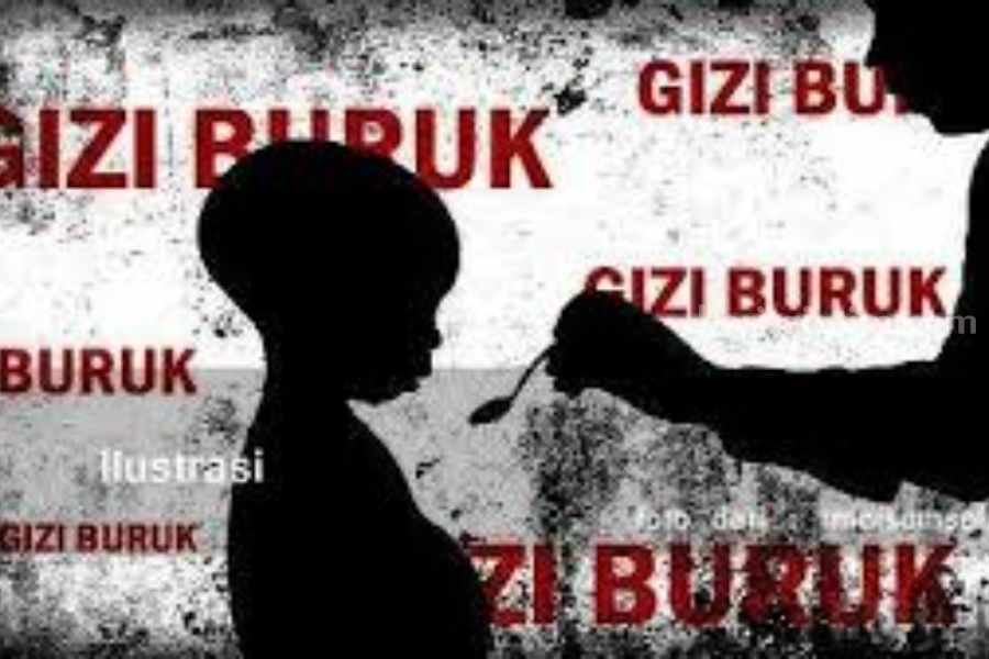 Gizi Buruk di Kabupaten Blitar Tembus 3.922 Kasus di 2022